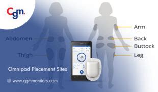 Omnipod Review Guide Personally Tried Tested