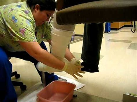 Getting A Cast YouTube