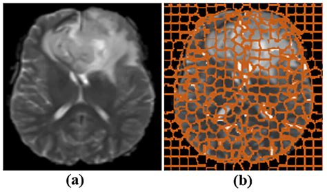 illustrates superpixel segmentation a original image t2 modality