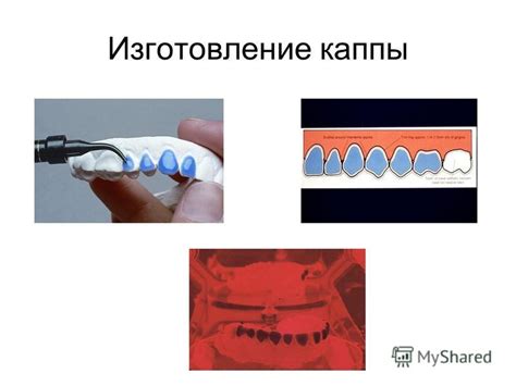Презентация на тему: "Отбеливание твердых тканей зубов ООО «Мисс ...