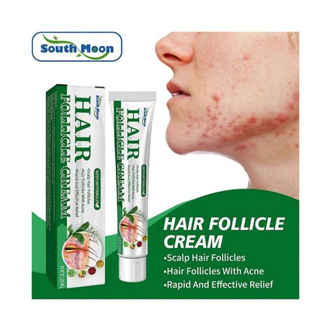 Seborrheic Dermatitis Cream Psoriasis Cream Scalp For Psoriasis