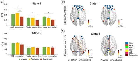 Dynamic Ncc Signatures Track Loss Of Consciousness During Propofol