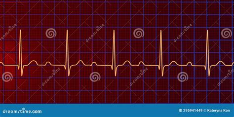 An Ecg Displaying 1st Degree Av Block 3d Illustration Royalty Free Cartoon