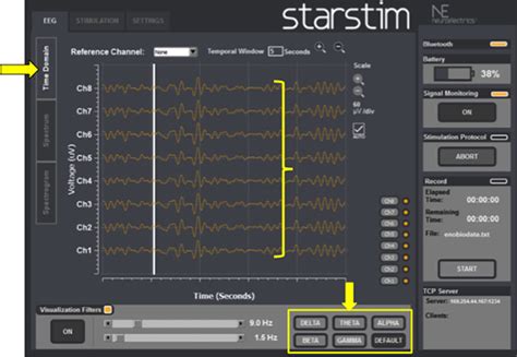 Simultaneous Eeg Monitoring During Transcranial Direct Current Stimulation