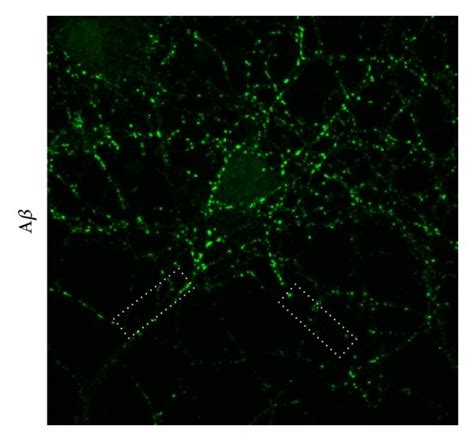 Testosterone Attenuated Oligomeric Aβ Induced Reduction Of Synapsin 1 Download Scientific
