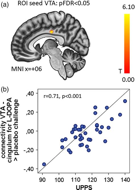 Impulsivity Modulates Vta‐mid‐cingulum Connectivity For Download Scientific Diagram