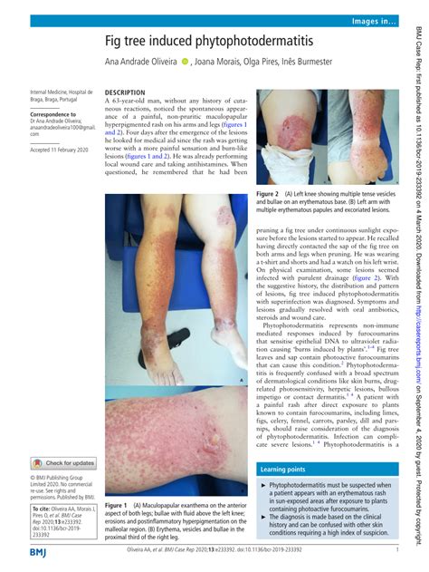 Pdf Fig Tree Induced Phytophotodermatitis Pdf Fig Tree Induced Phytophotodermatitis