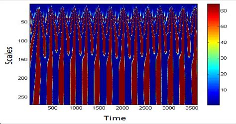Figure 4 From Wavelet Transform Based Analysis Of Qrs Complex In Ecg