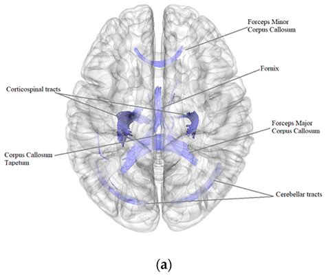 Cerebral White Matter Tracts