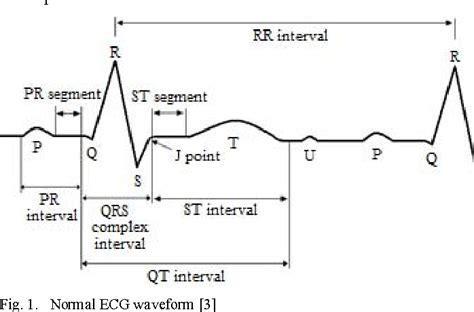 figure 1 from classification of ecg signals using machine learning