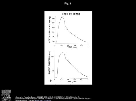Sex difference in the mechanical properties of the abdominal aorta in human beings Björn