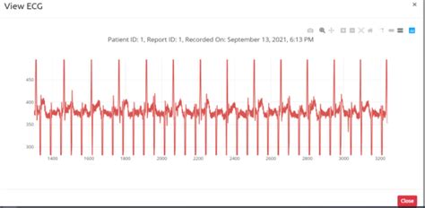 Github Ibrahim 995remecg An Iot Based Remote Electrocardiography