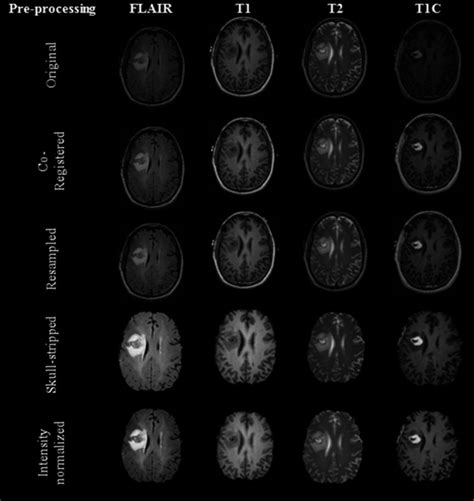 impact of image preprocessing methods on reproducibility of radiomic