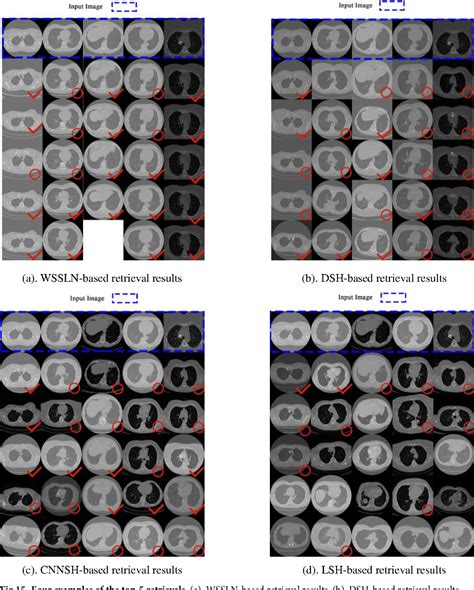 Figure 15 From Effective And Efficient Content Based Similarity Retrieval Of Large Lung Ct