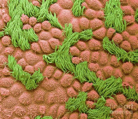 Fallopian Tube Photograph By Steve Gschmeissnerscience Photo Library
