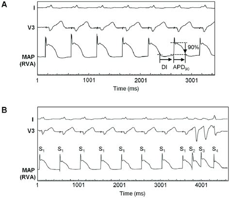 Representative Map Recordings Monophasic Action Potentials Maps Download Scientific Diagram