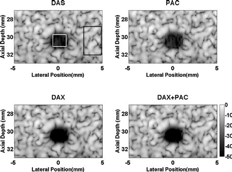 Experimental Cysts For Standard Delay And Sum Das Beamforming With Download Scientific