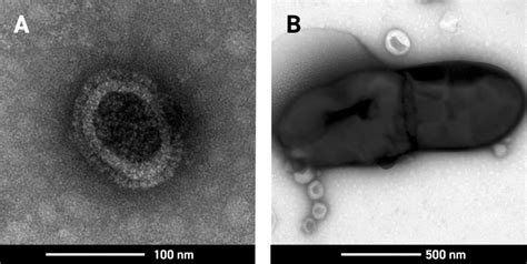 Fighting Pneumococci The Biggest Bacterial Killer Microscopy Australia