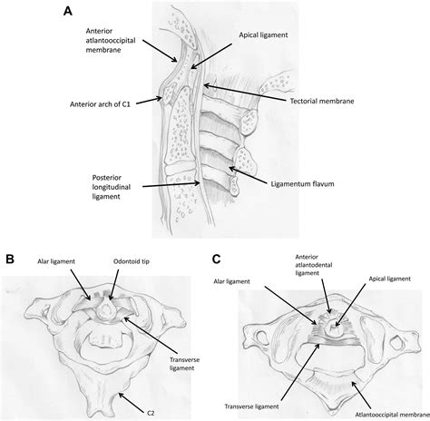 Neuroimaging In Craniovertebral Anomalies As Seen In The Tropics