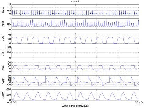 Case 6 Waveform Plots 60 Second Plots
