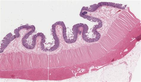 Transitional Epithelium Labeled Basement Membrane