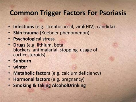 Psoriasis Pptx