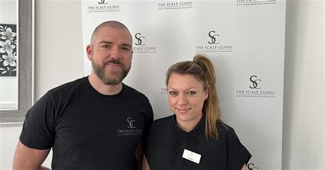 The Scalp Clinic | What to Expect? | Scalp Micro-Pigmentation