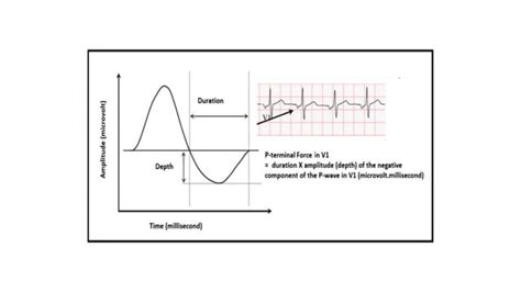 Cryptogenic Strokepptx Heart And Cardiovascular Diseases Diseases