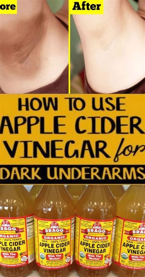 Get Rid Of Dark Underarms With This Secret Apple Cider Vinegar Remedy ...