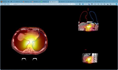 Associations Of Patients Dicom Objects For Radiotherapy General Orthanc Users