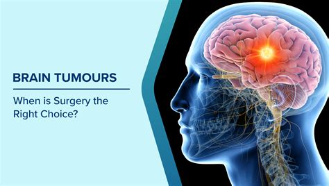 Brain Tumours Types Risks Surgery Indications And Recovery Guide Max Hospital