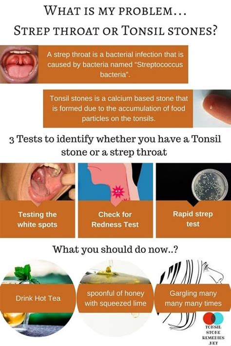 What is my problem… Strep throat or Tonsil stones?