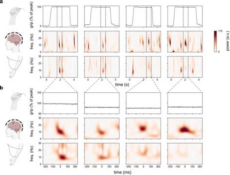 Transient Beta Activity And Cortico Muscular Connectivity During