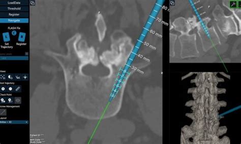 Spine Navigation