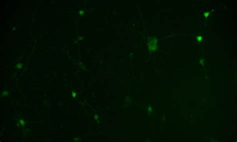 Neuronal Fluorescence Imaging