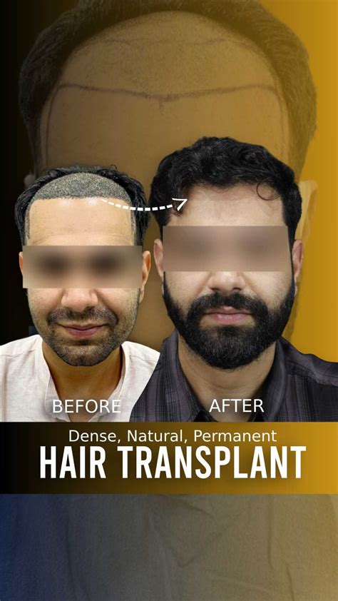 Dr Adarsh Tripathi Dr Adarsh Tripathi • Instagram Photos And Videos