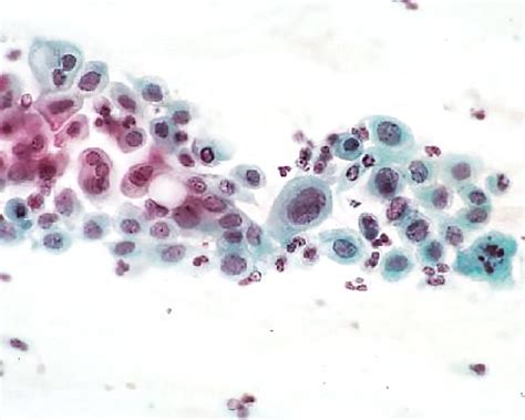 Asc H University Of Wisconsin Madison