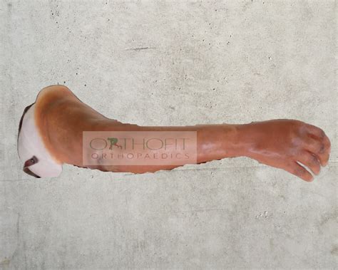 Orthofit Silicone Prosthesis Orthofit Orthopaedics Limited