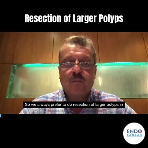 Endocollab™ Gastroenterology And Endoscopy Education On Linkedin Resection Of Larger Polyps
