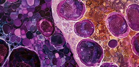 Pathology Cpt Codes Billing And Credentialing Cranberry Twp Pittsburgh