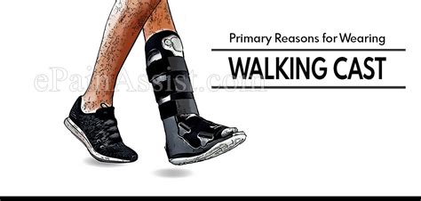 The Primary Reasons For Wearing A Walking Cast Its Types And Do You Need