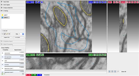 Ilastik Voxel Segmentation Workflow Beta