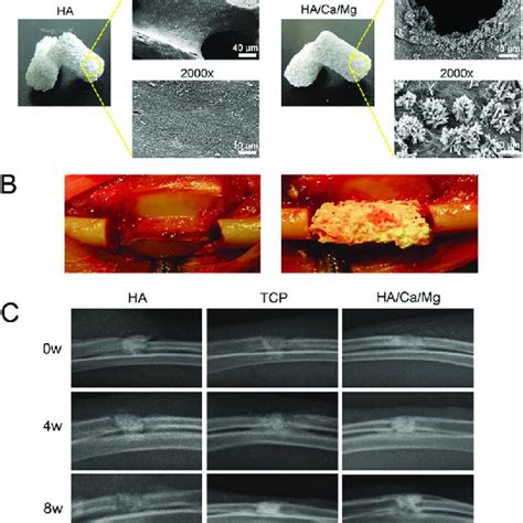 Scheme 1 A Segmental Radial Bone Defect Model Used To Evaluate The In