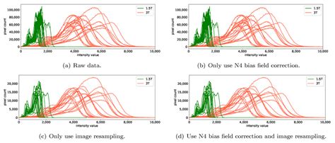 Impact Of Preprocessing Methods On Image Histograms Of Brain Mri Images Download Scientific