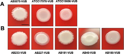 Acinetobacter On Blood Agar