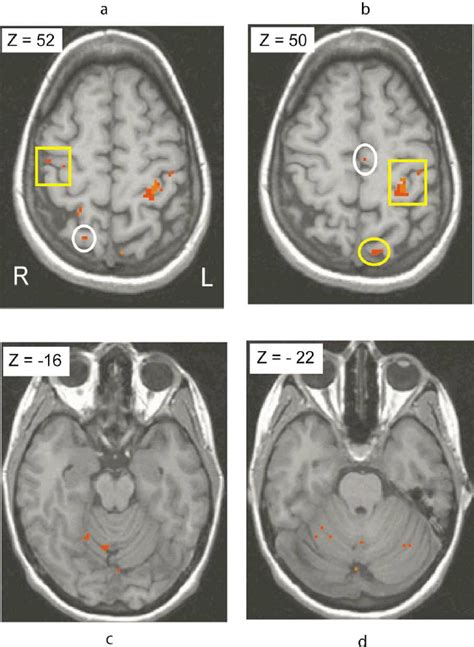 Comparison Of Bimanual Versus Left Handed Execution Of Finger Sequences Download Scientific