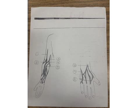 Peripheral Vein Hall Quiz