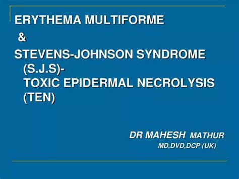 Ppt Erythema Multiforme And Stevens Johnson Syndrome Sjs Toxic