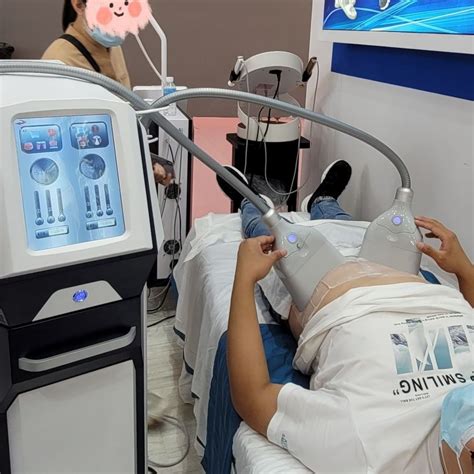 Cryolipolisis Steinx