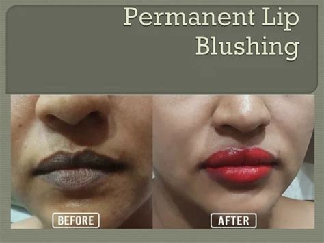 Ppt Permanent Lip Blushing Powerpoint Presentation Free Download
